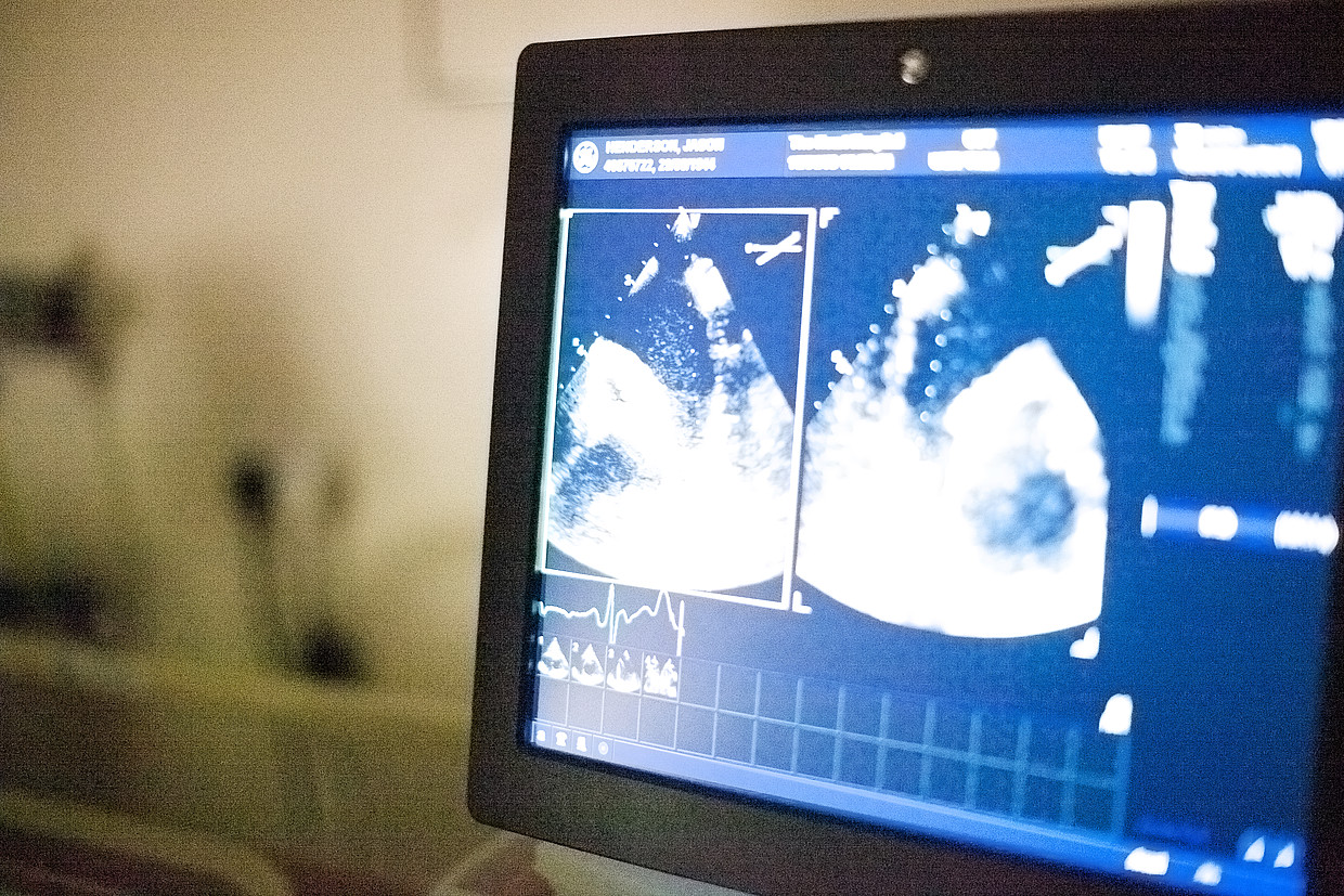 Cardiovascular science - Bristol Health Partners